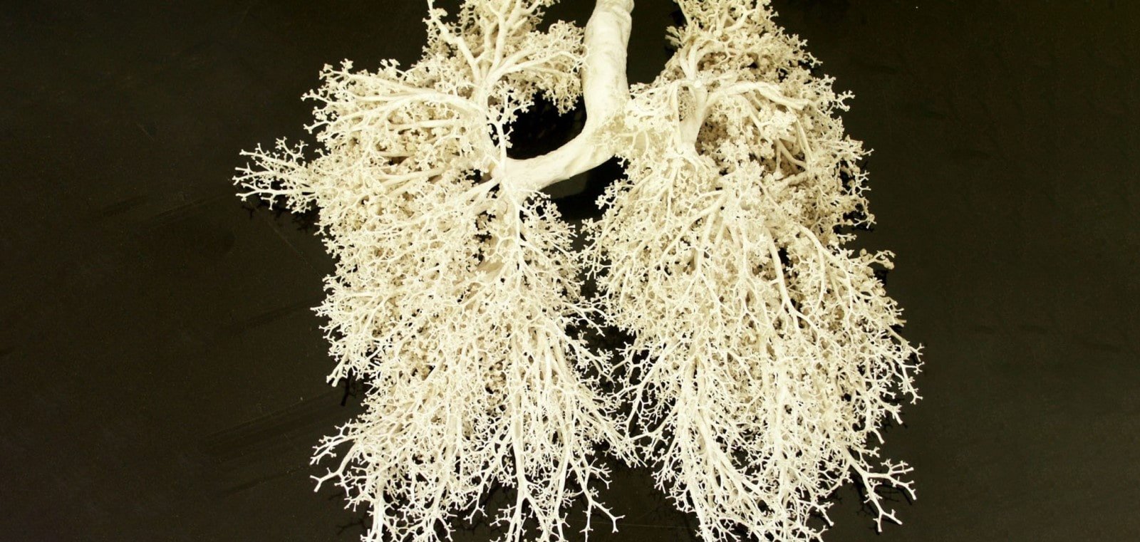 When is bronchitis worth taking seriously? | Mister-Blister